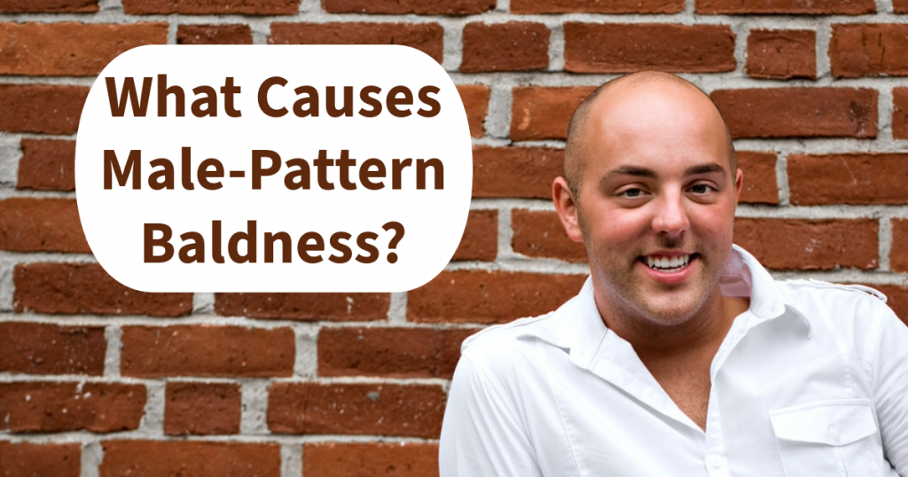 What Causes Male Pattern Baldness La Fue Hair Clinic Los Angeles